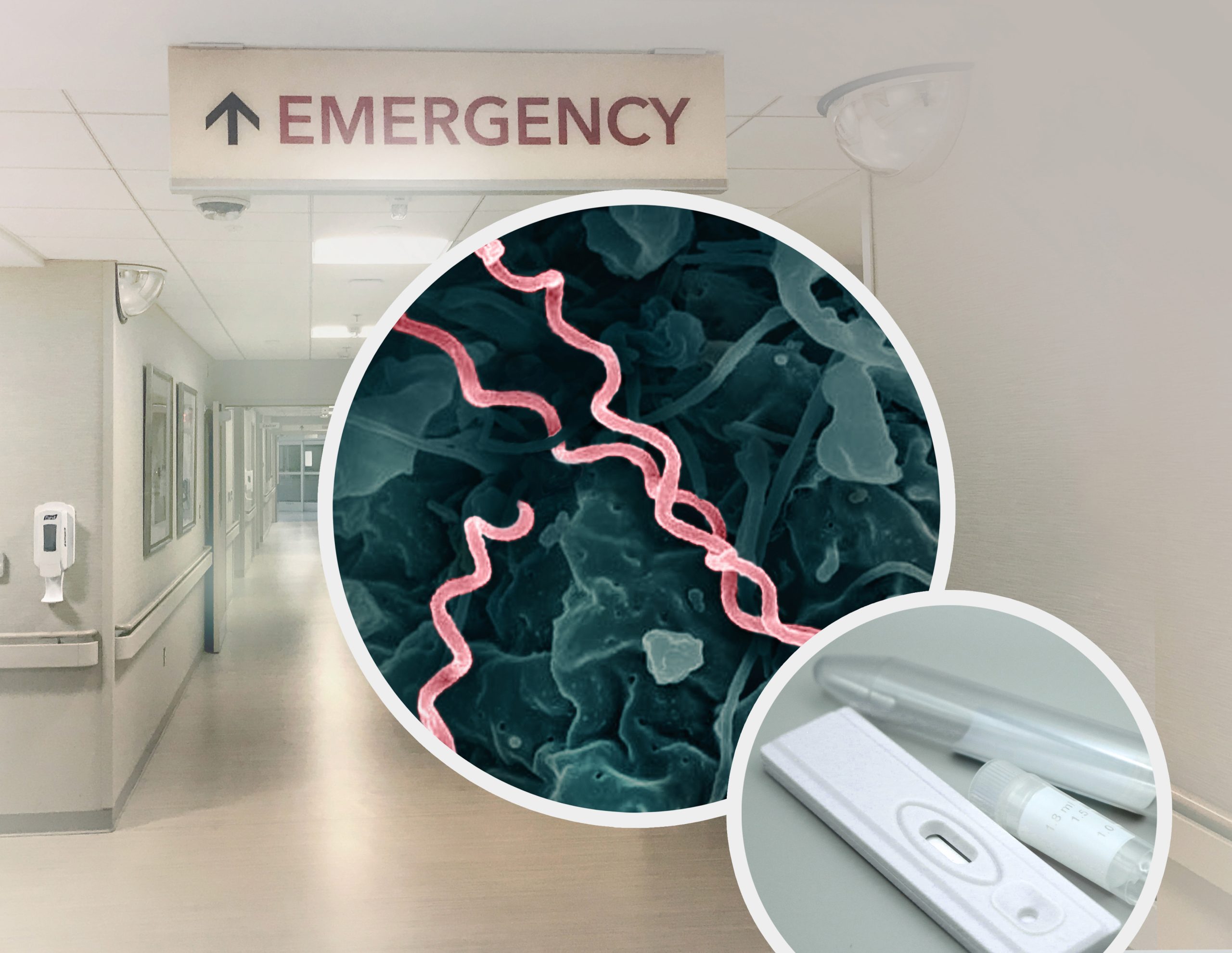 Syphilis Epidemic Under the Radar? Revolutionary Testing Strategy ...