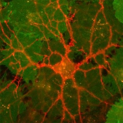 Unlocking the Mysteries of Brain Chemistry With New Dopamine Sensors