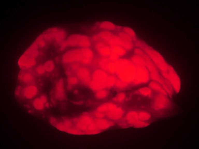 Stanford Scientists Discover Aging May Suppress Cancer, Not Fuel It