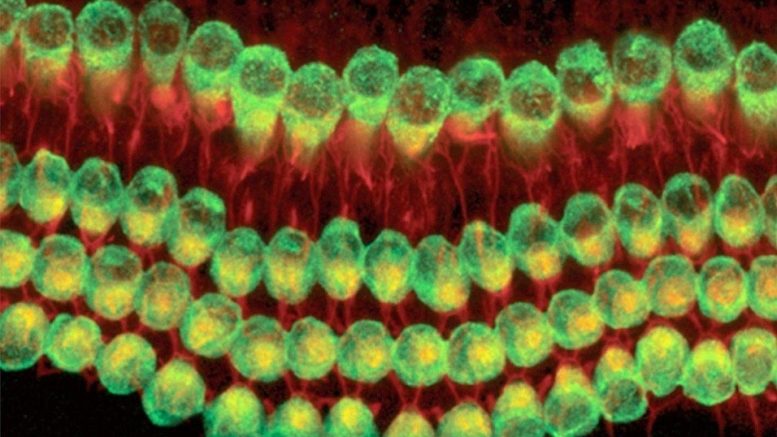 Restoring Hearing: New Tool To Create Ear Hair Cells Lost Due to Aging ...