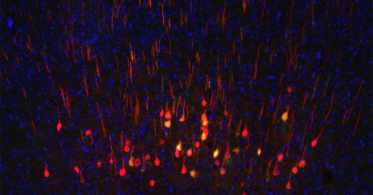 Brain Power Renewed: A Biomarker’s Predictive Magic on Neuron Regeneration