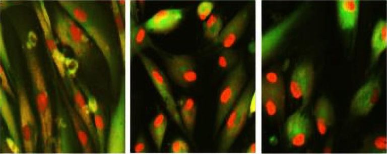 Age Reversal Breakthrough: Harvard/MIT Discovery Could Enable Whole ...