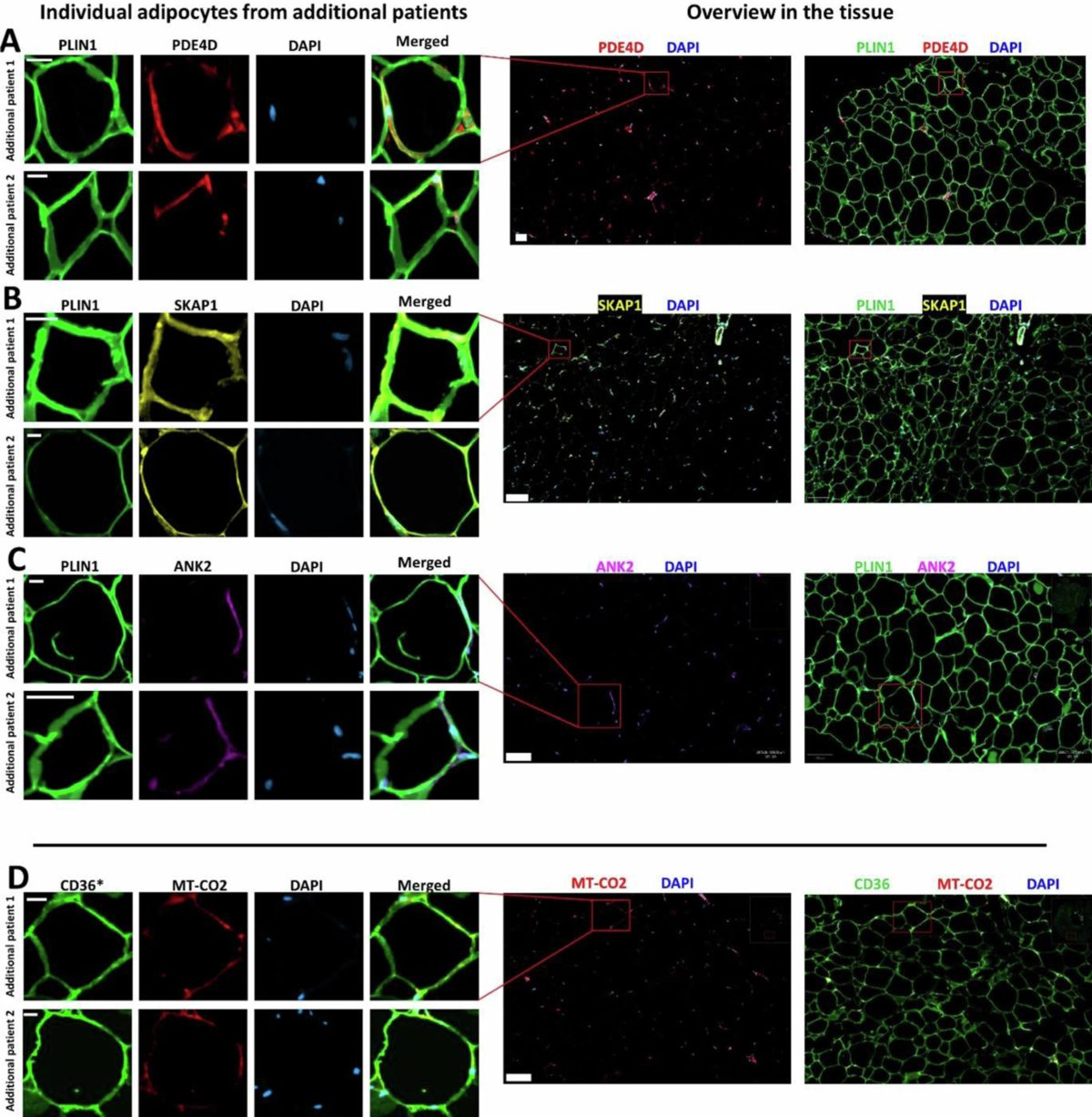Scientists Find Never-Before-Seen Fat Cell Types That May Hold the Key ...