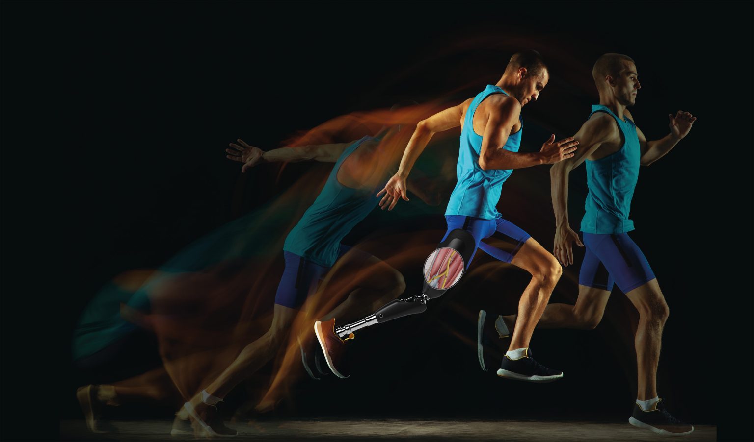 Feeling the Future: How a New Prosthetic Leg Restores Natural Sensations