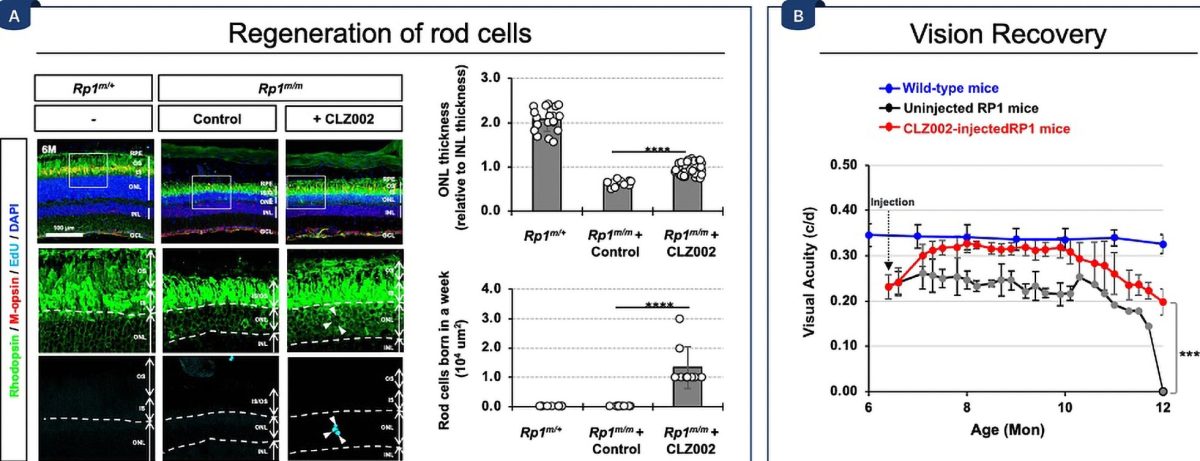 Breakthrough Drug Restores Vision: Researchers Successfully Reverse ...