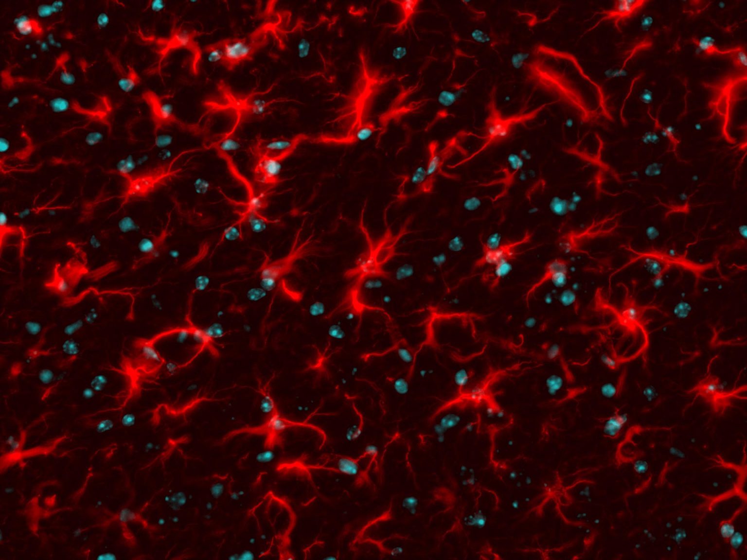 Fixing Rogue Brain Cells To Treat Neurodegenerative Diseases Like ...