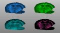Anti-Inflammatory Molecules Discovered That Decline in the Aging Brain