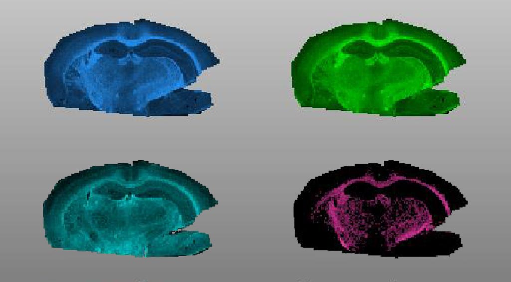 Anti-Inflammatory Molecules Discovered That Decline in the Aging Brain
