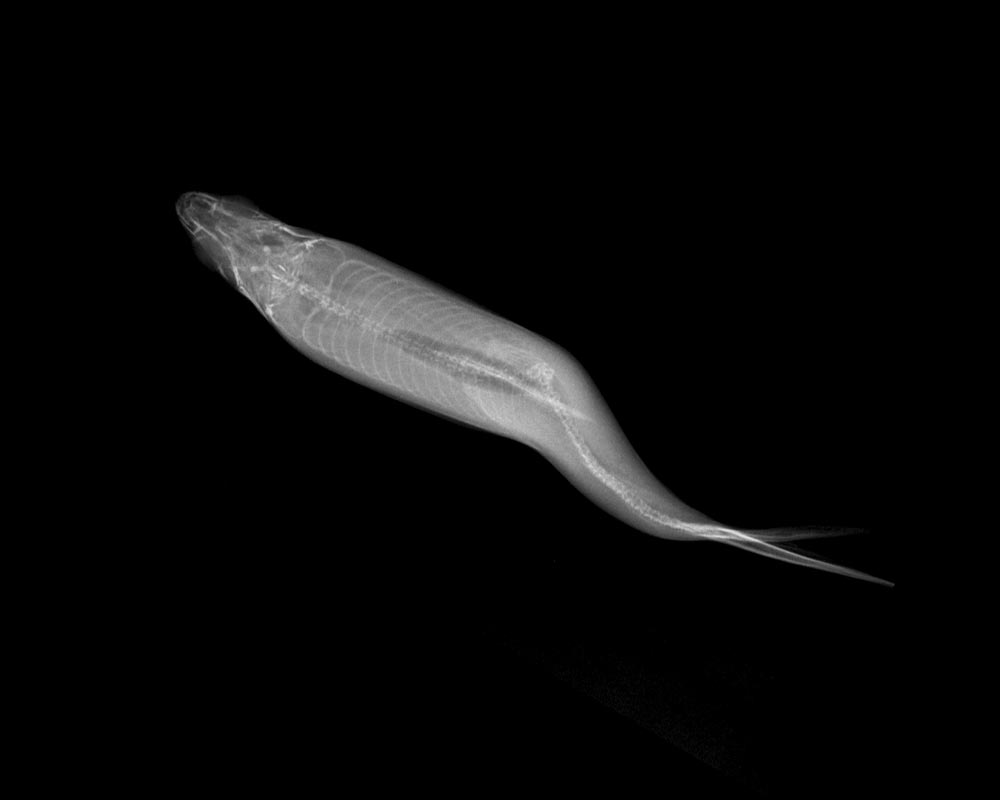 How Ear Bones of a Fish Unraveled the Mystery of Spinal Deformities