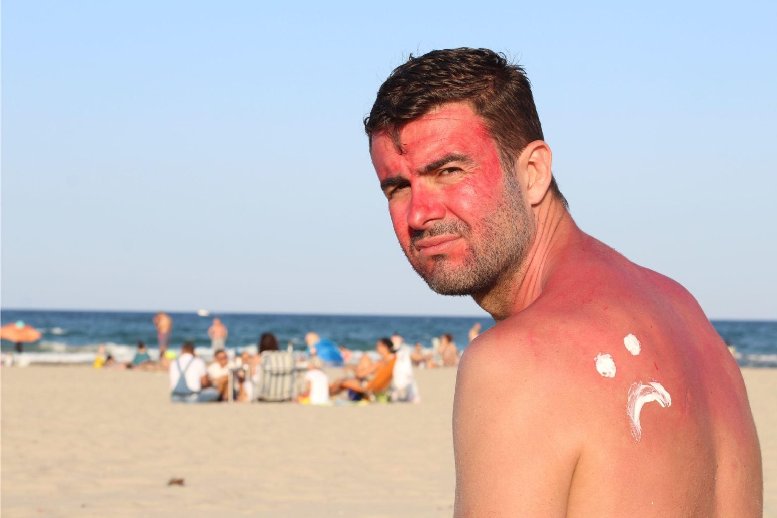 Vacationers Beware – Short, Sun-Seeking Trips Can Disrupt the Skin’s ...