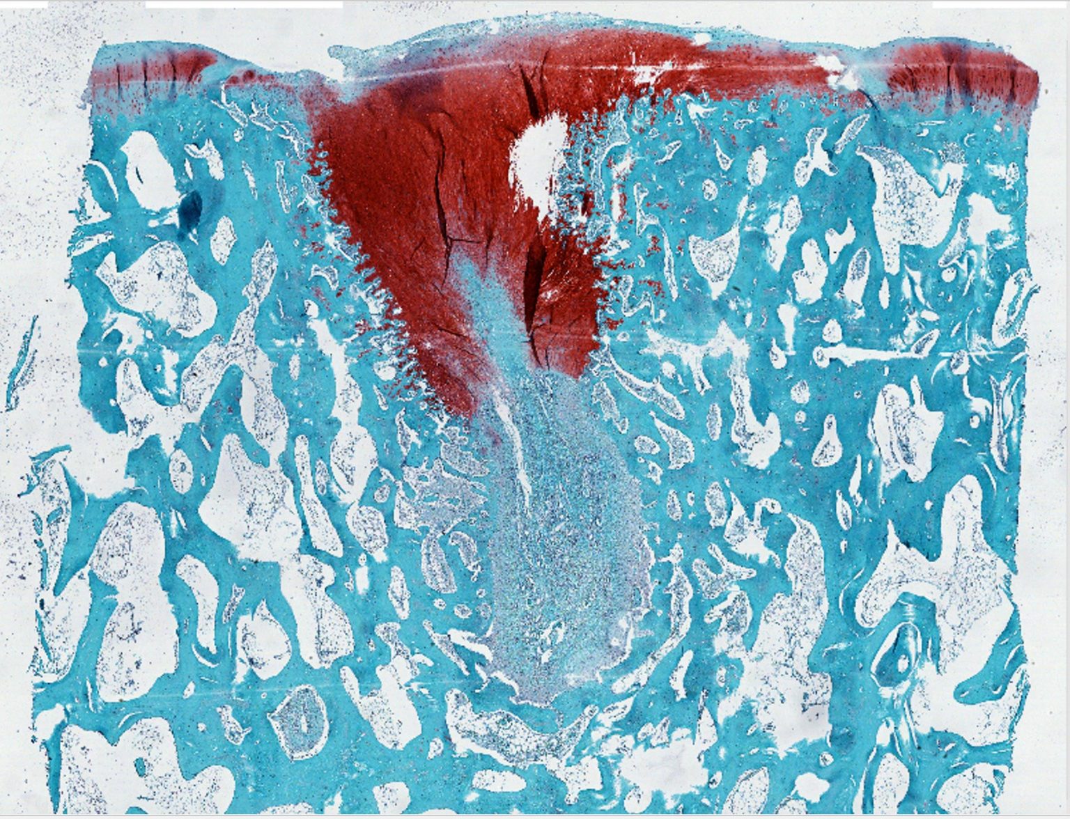 Cartilage Regeneration Breakthrough Ushers In a New Era of Joint Health