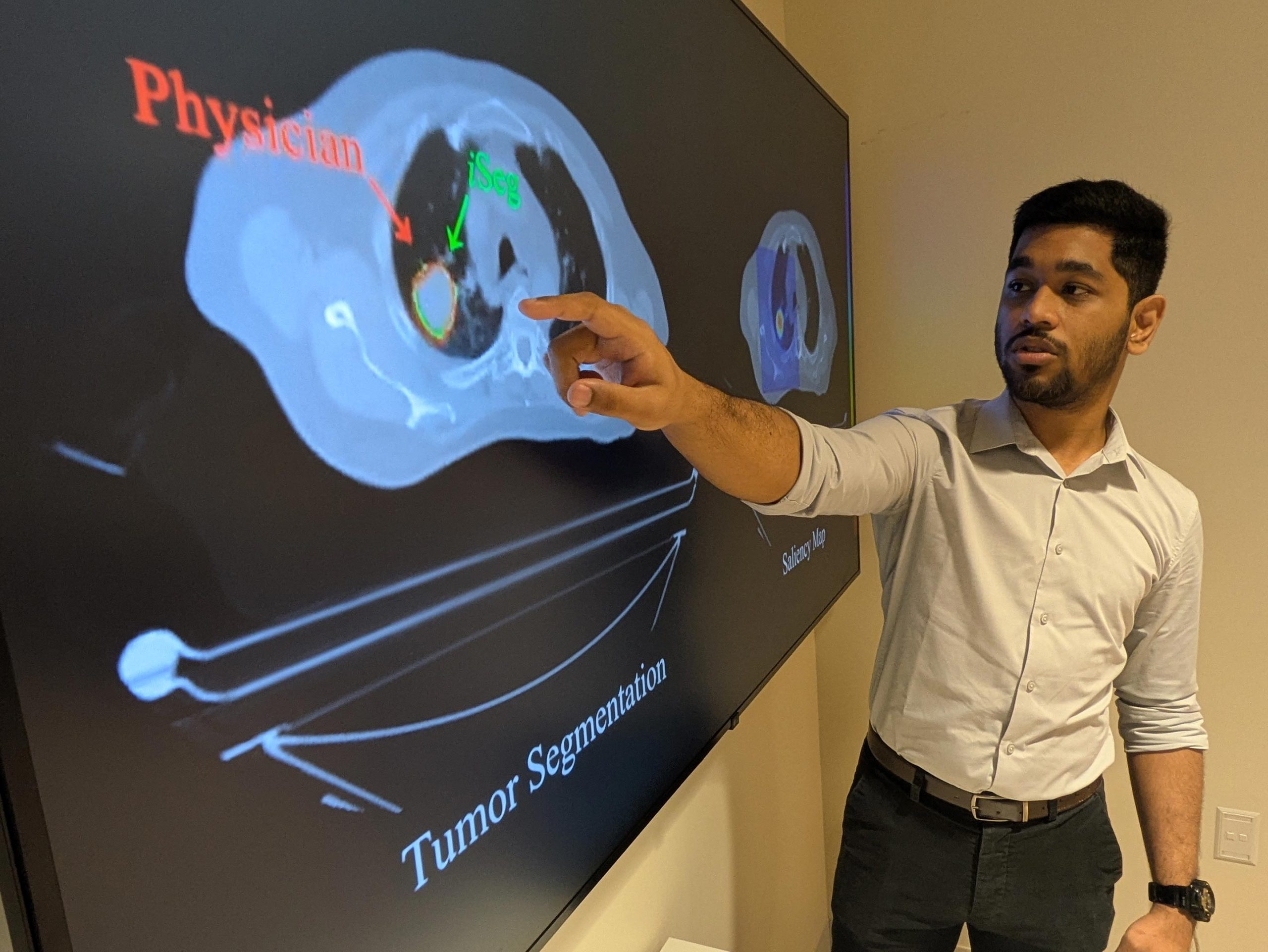 AI Detects Hidden Lung Tumors Doctors Miss — And It’s Fast