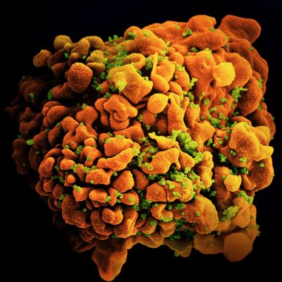 NIH Launches Clinical Trial of Three mRNA HIV Vaccines