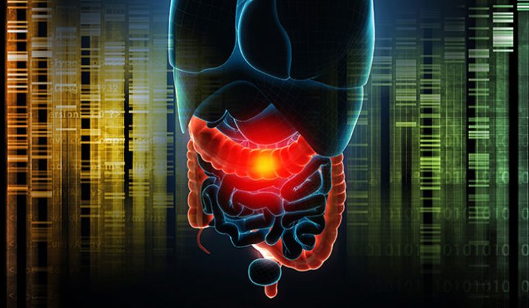 Yale Researchers Reveal Role of INAVA Gene in IBD