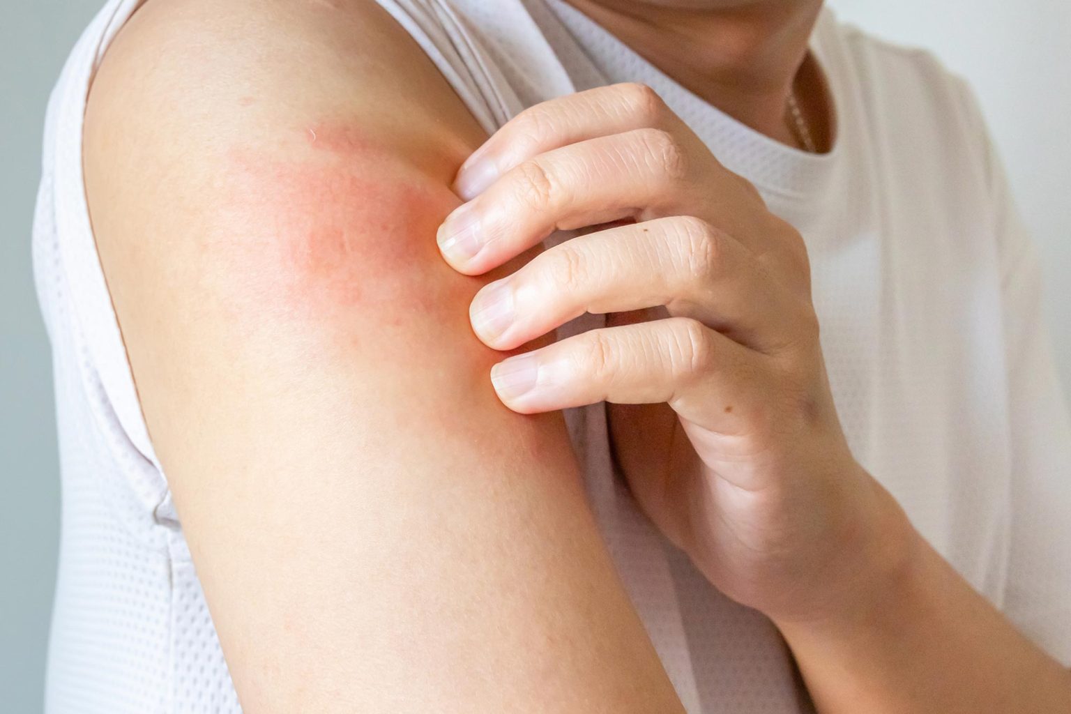 Scratching Your Itch Feels Amazing – But Here’s What It’s Really Doing ...