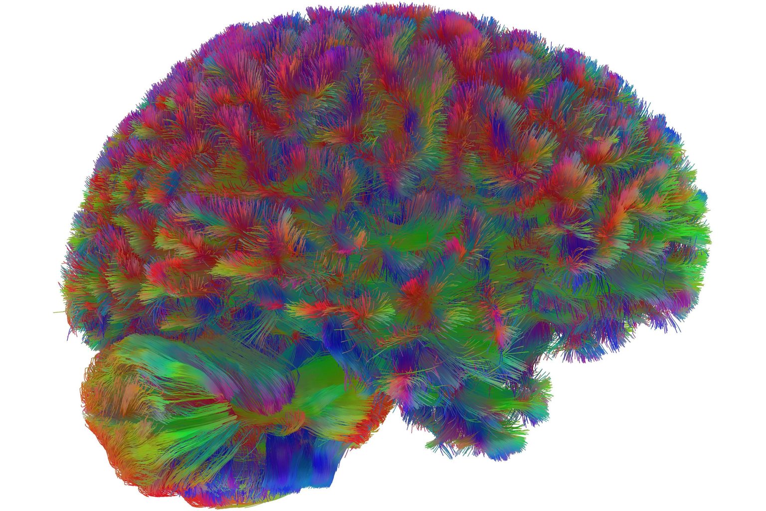Your Brain Has Five Secret Ages, and One Lasts Most Of Your Life