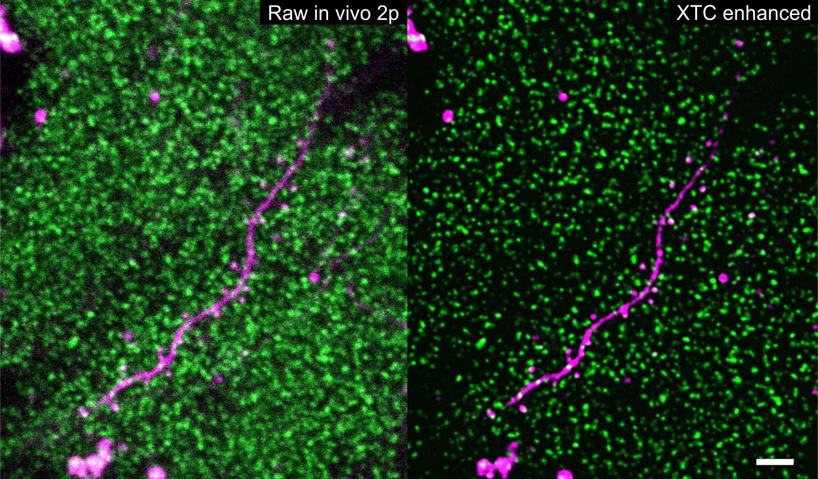 Synaptic Secrets Revealed: Scientists Use AI To Watch Brain Connections ...