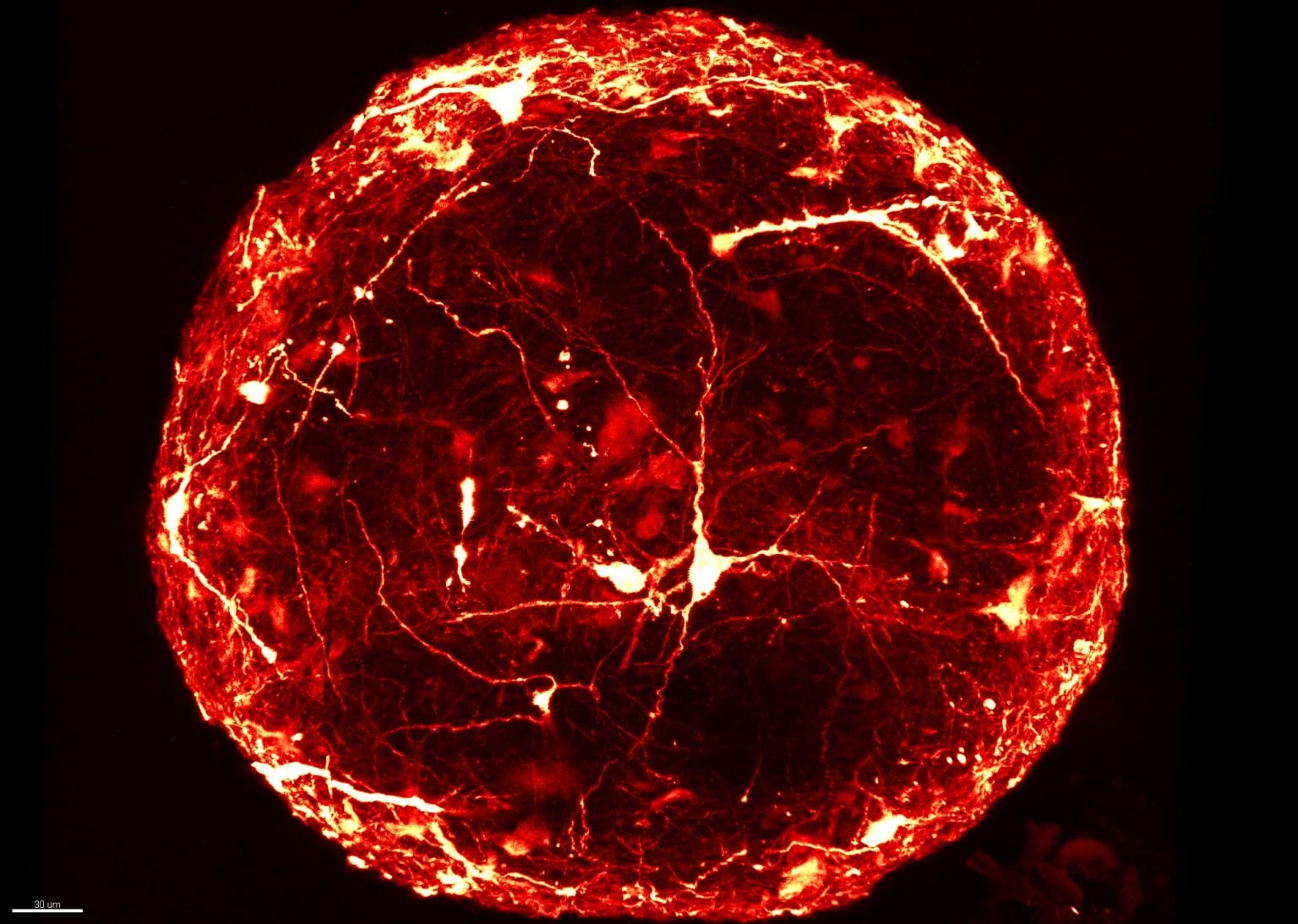 Peeking Inside Human “Mini-Brains” to Understand the Brain, Study ...