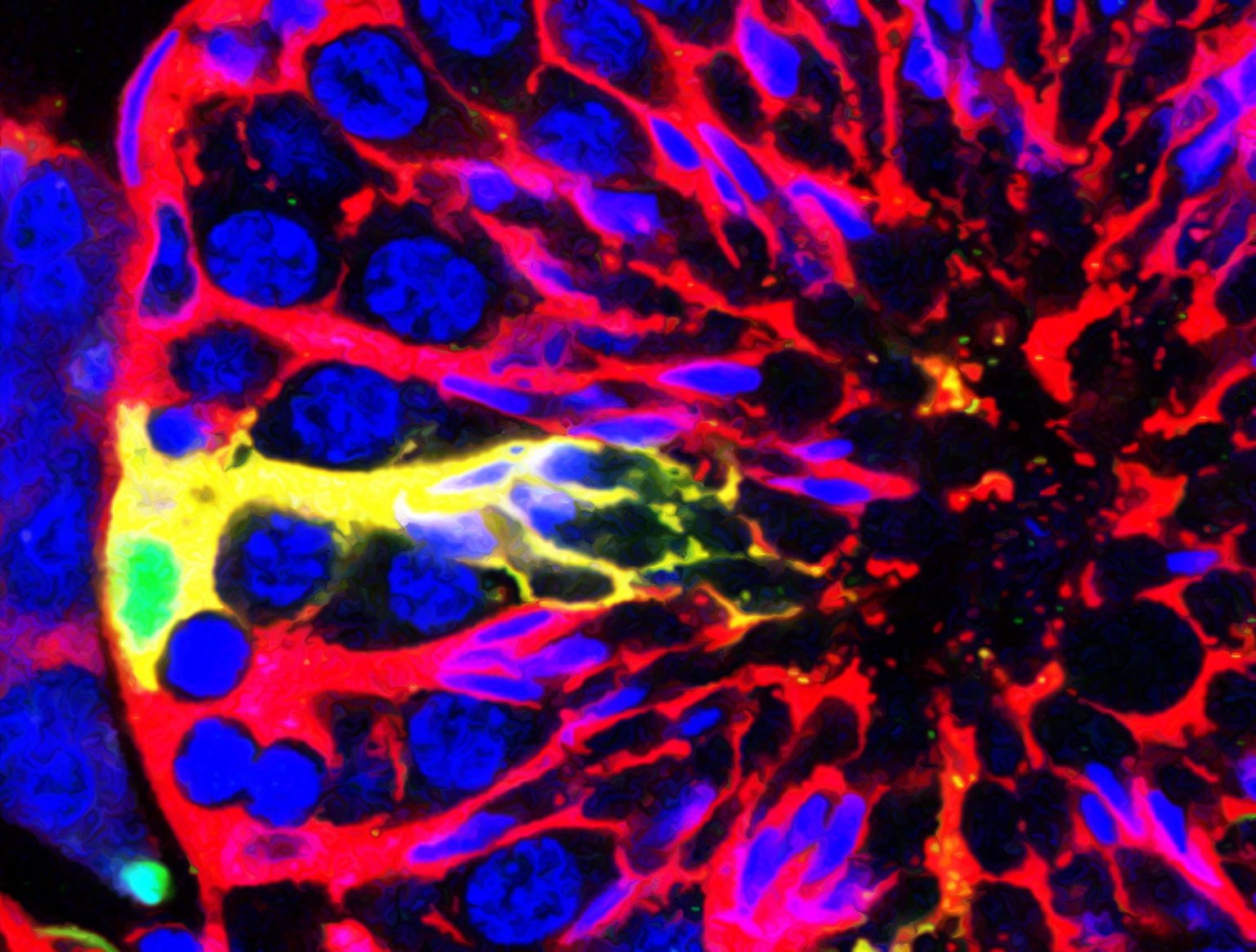 Reproductive Sciences Experts Discover Gene Crucial To Sperm Cell