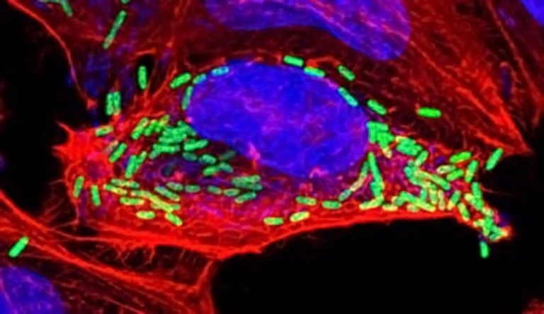 Bacteria Can ‘Outsmart’ Programmed Cell Death Overriding an Immune ...