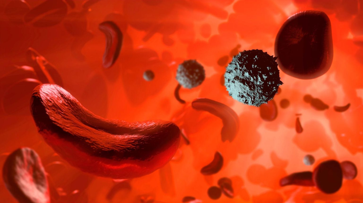 Startling New Research: Sickle Cell Disease Is 11 Times More Deadly ...