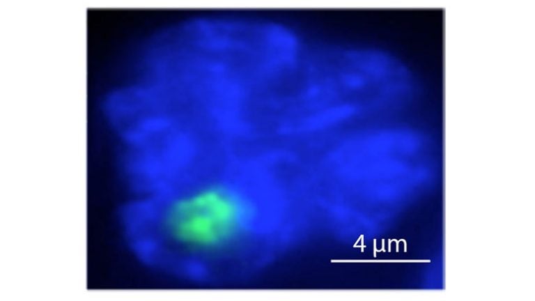 Cracking the Nucleolar Code: MIT Unravels Evolutionary Secrets of the ...