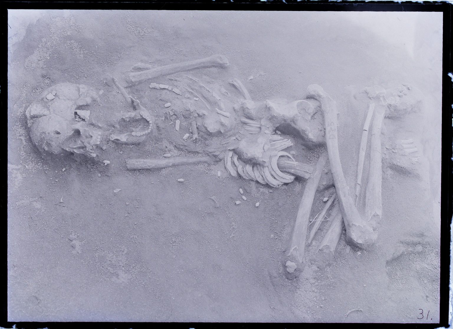 Skull-Shaping Secrets – Scientists Shed New Light on the Ancient ...