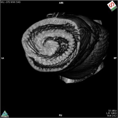 Amazing New 3D Images of Shark Intestines Show They Function Like ...