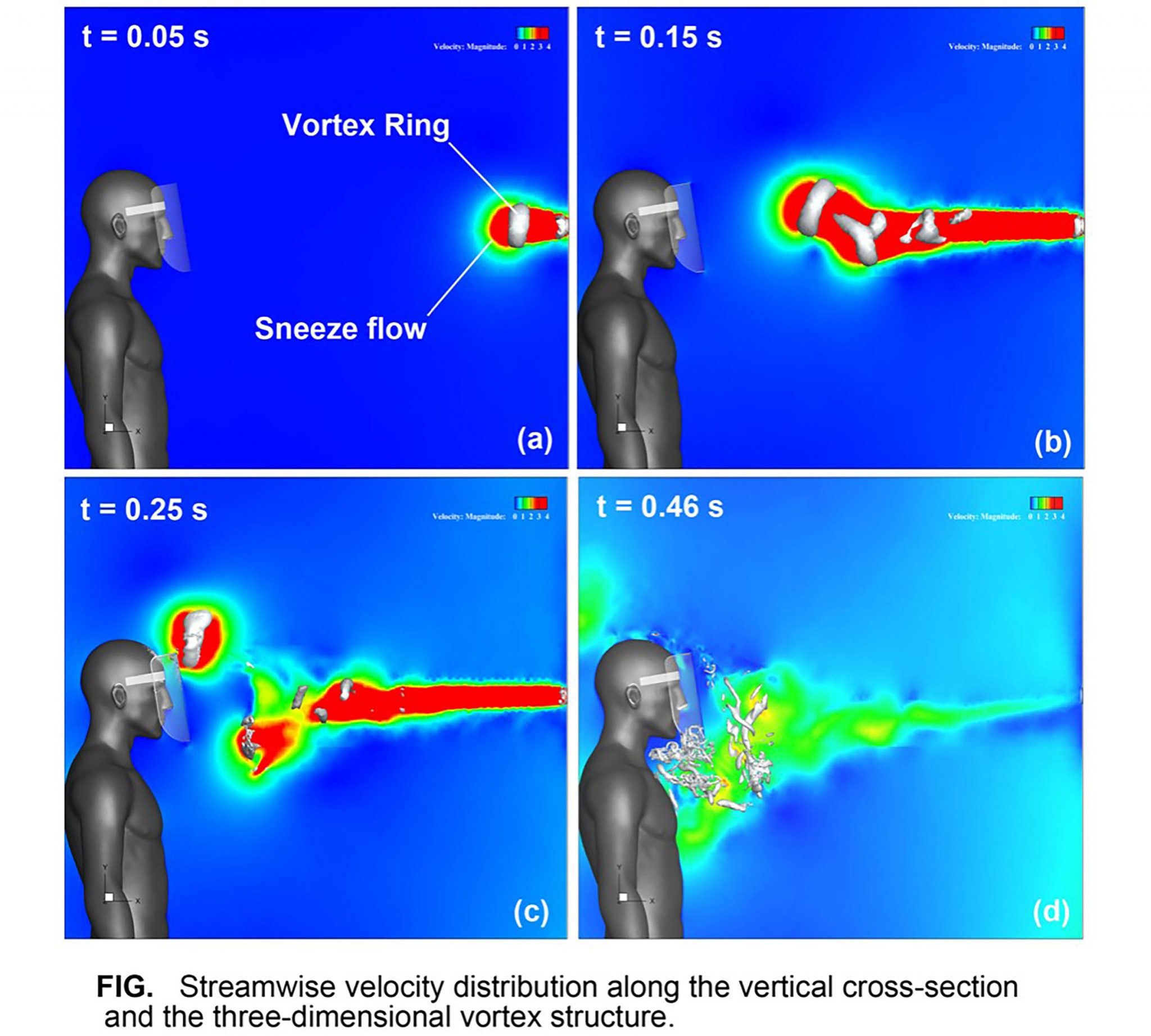 COVID Face Shields No Match for Sneeze Vortex Rings