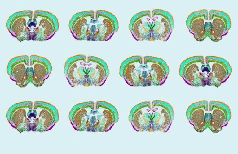 A Neuroscience Milestone: Complete Cellular Mapping of a Mammalian Brain