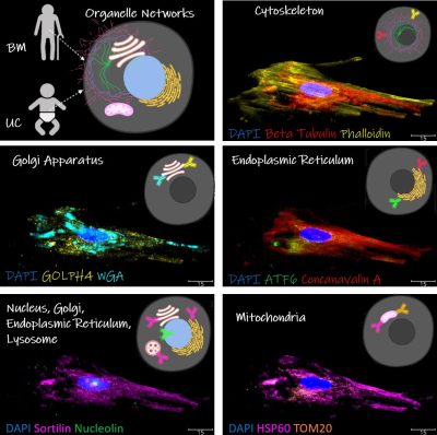 The Inner Workings of Stem Cells: A Game-Changer for Personalized Medicine