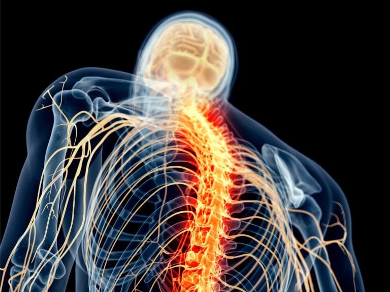 New Hope for Those Living With Paralysis: Nerve Stimulation Therapy ...