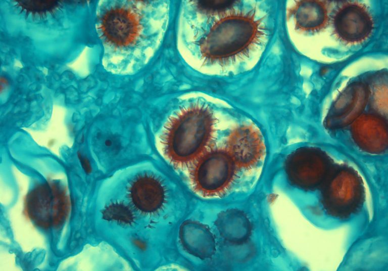 "Completes the Circle": A 40-Year Scientific Journey Leads to a New ...