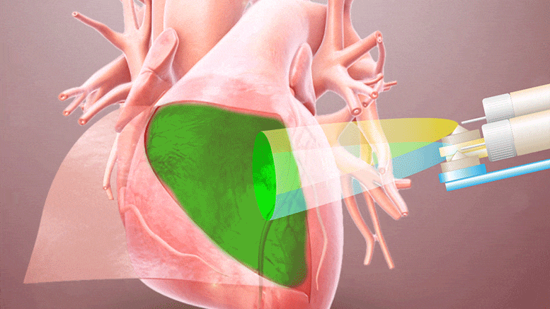 Bio-Inspired Hydrogel Protects the Heart From Adhering to Surrounding ...