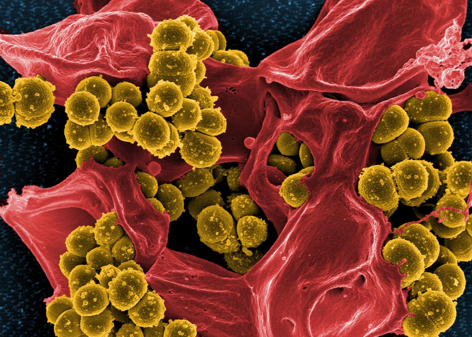 Staphylococcus: From Harmless Skin Bacteria to Deadly Pathogen