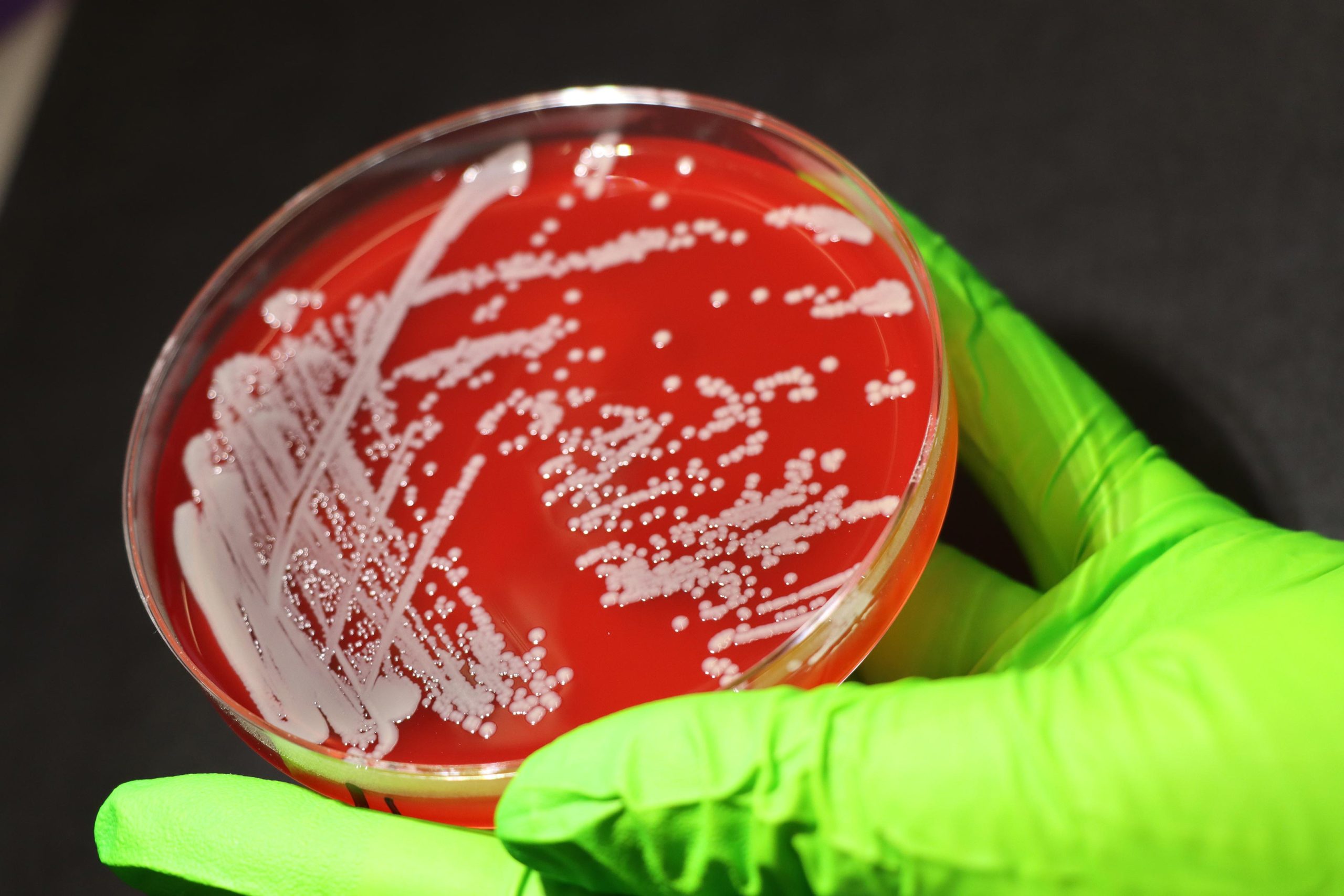 Genetic Breakthrough Reveals How Superbugs Outsmart Our Defenses