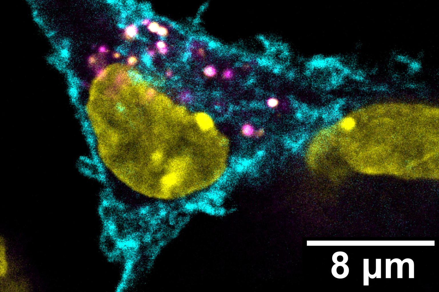 A Stealthy Way To Combat Tumors: Immune Cells Disguised As Cancer Cells