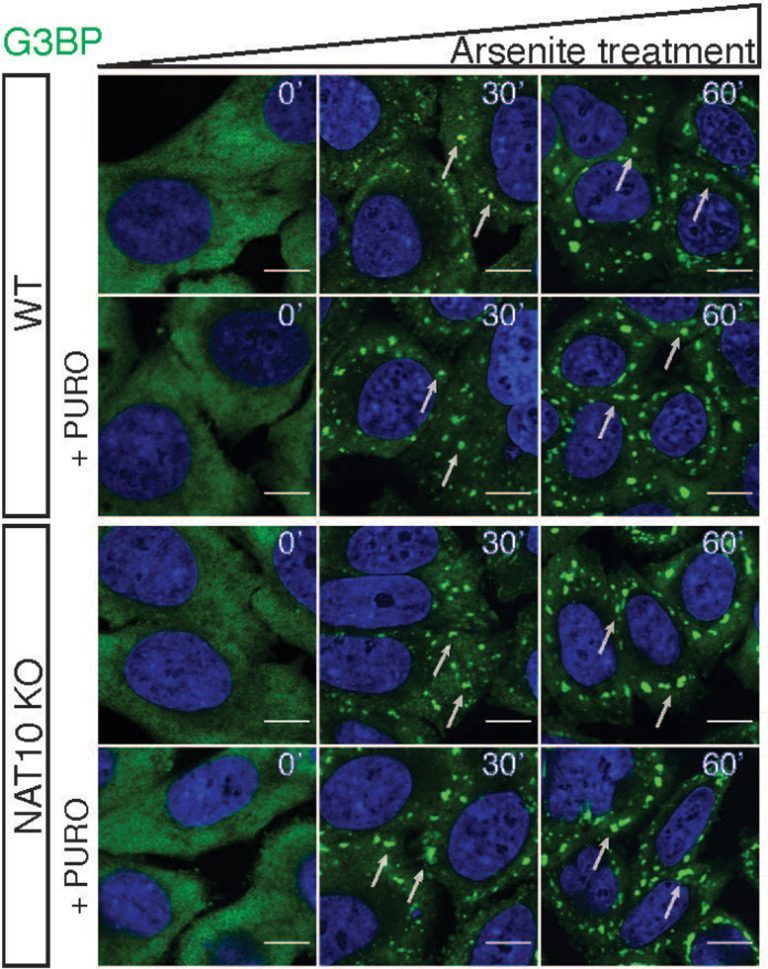 New Discovery Reveals How Cells Defend Themselves During Stressful ...