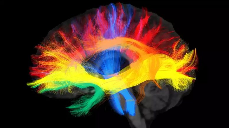 Infant Brain Circuitry Shaped by Language Exposure