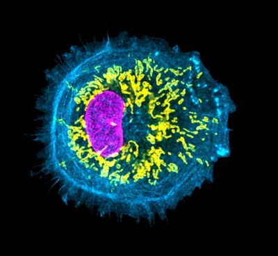 Microglia's Key Function in Brain Development Uncovered