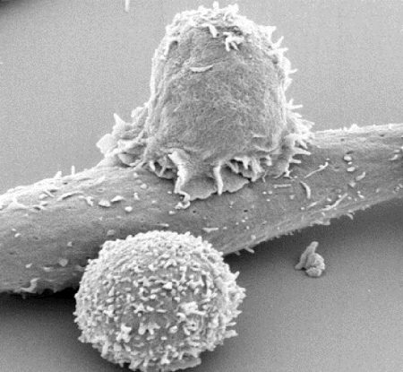 Scientists Unlock the Secret to Supercharged Cancer-Fighting T Cells