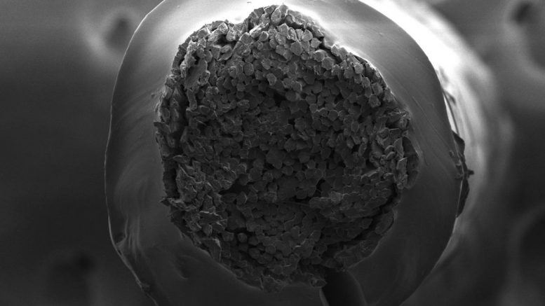 Healing Innovation: MIT Engineers Create “Smart Sutures” That Can ...