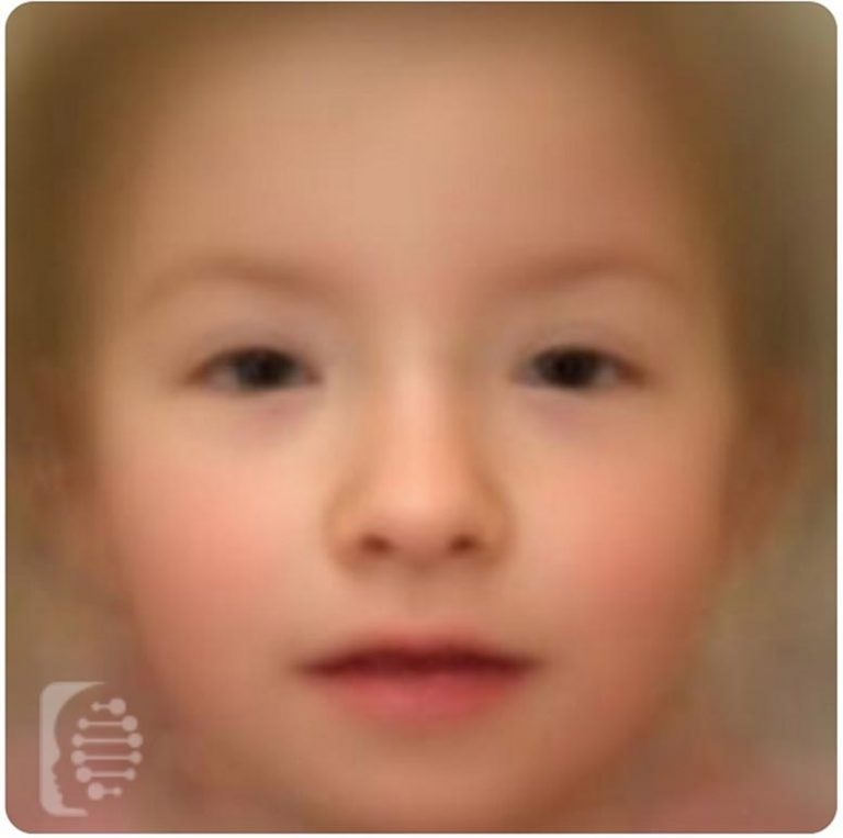 New Rare Disease Uncovered With Own Facial Features, Cardiac Defects ...