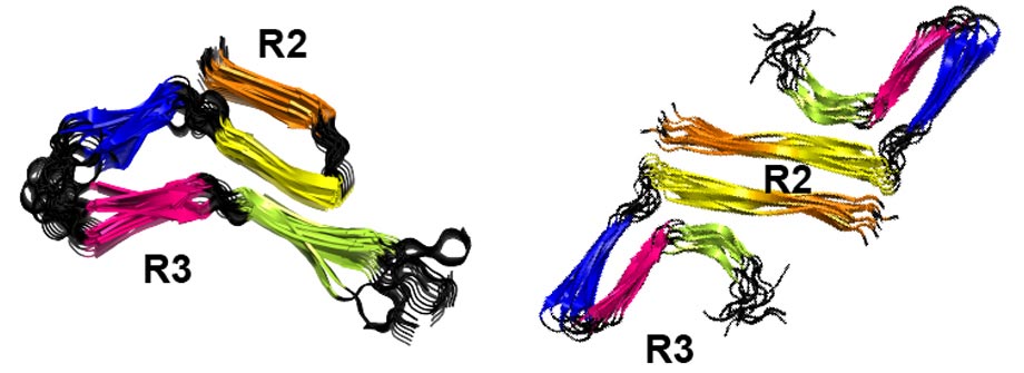 How Tau Tangles Form in the Brain: MIT Scientists Shed Light on ...