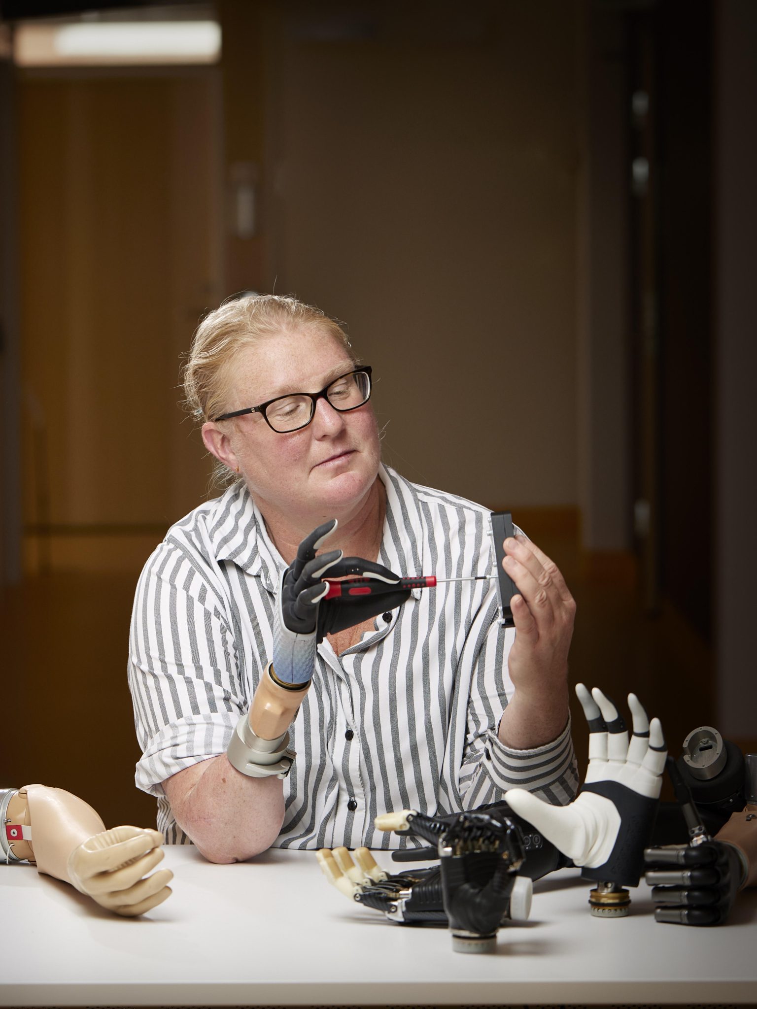 Revolutionizing Prosthetics – Scientists Develop Bionic Hand That ...