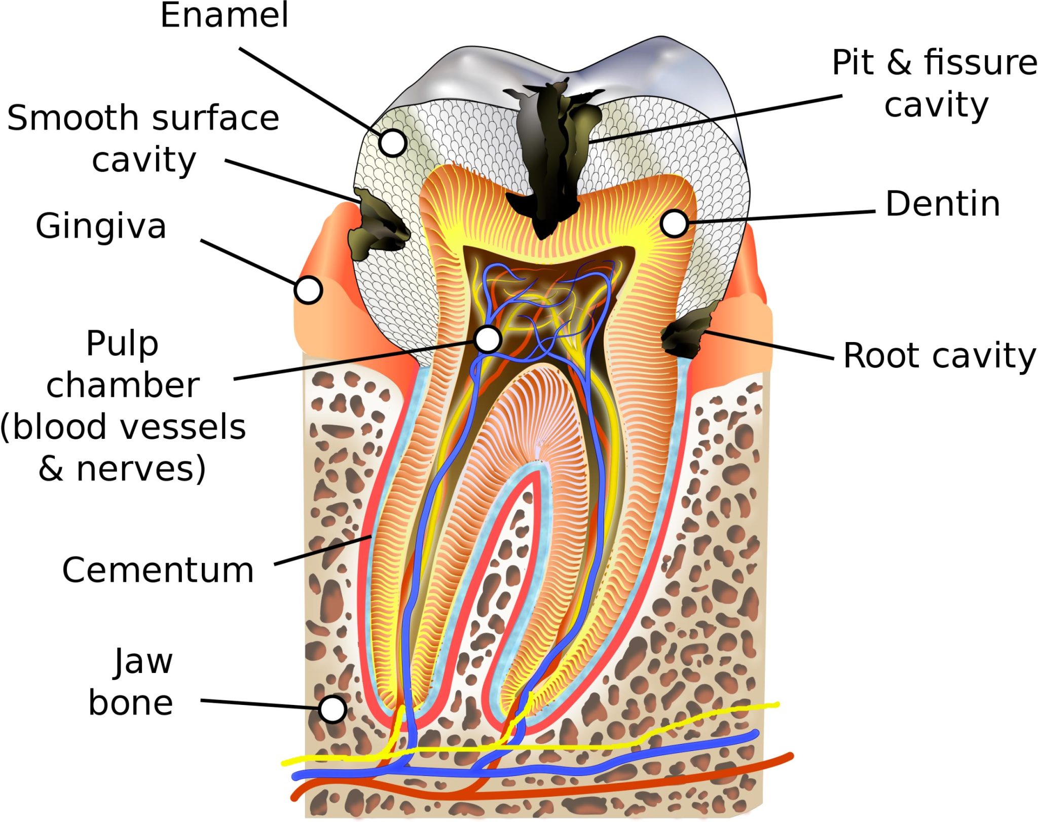 Using Vapes May Increase Risk of Developing Dental Cavities