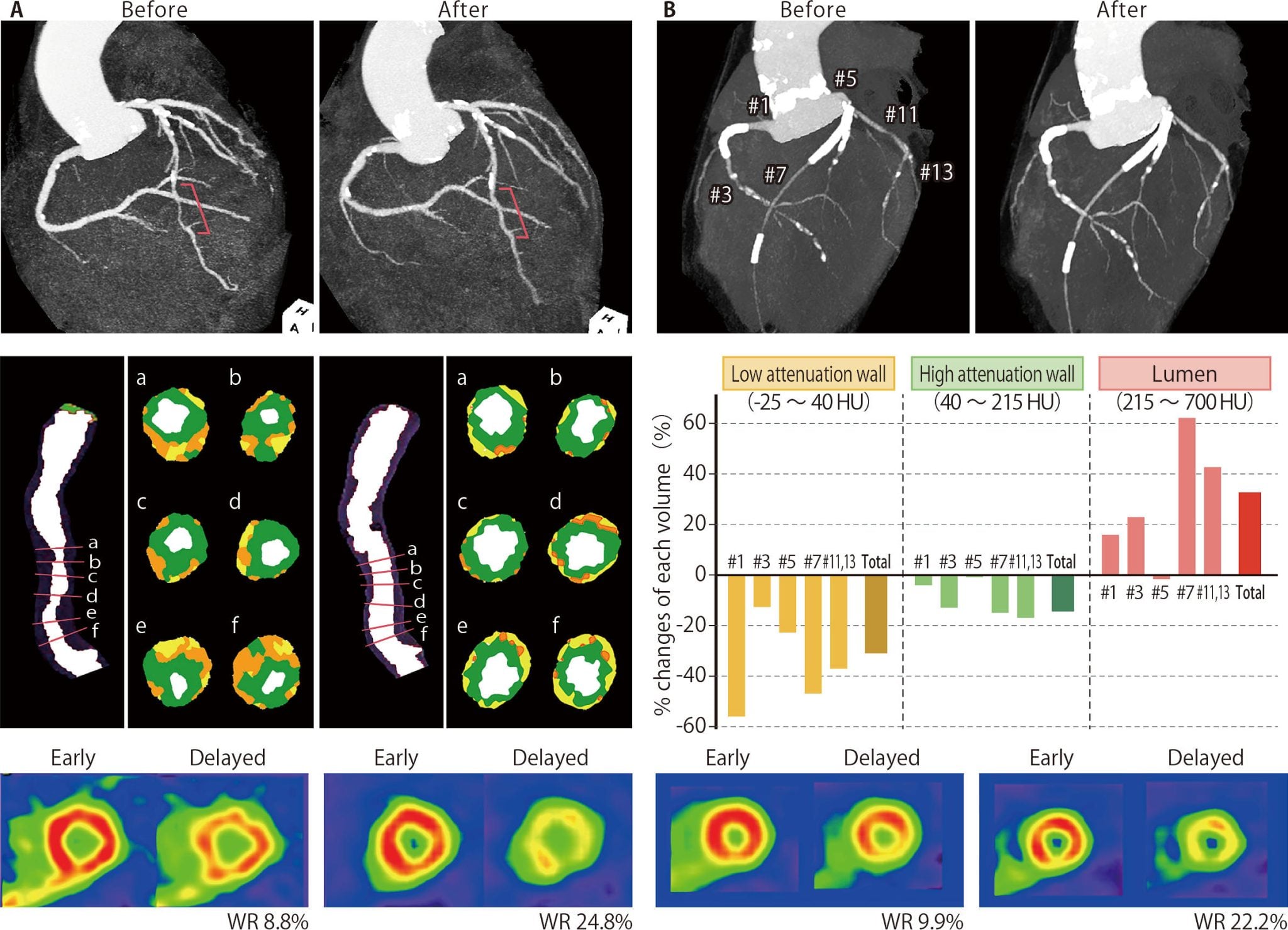 “Remarkable” Results – Scientists Say This Supplement Reversed Heart Damage