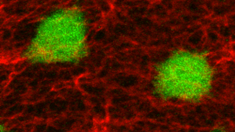 Researchers Discover How Cancer Cells Remain Dormant for Years Before ...