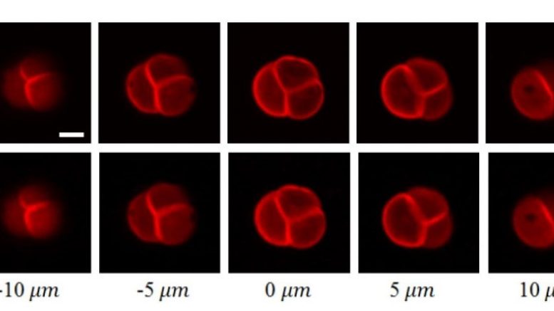 SOFISM: Microscopy Beyond the Resolution Limit