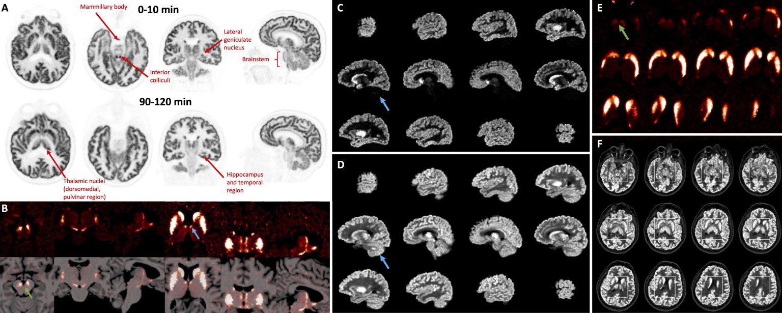 Groundbreaking New System Provides Never-Before-Seen Images of the Brain